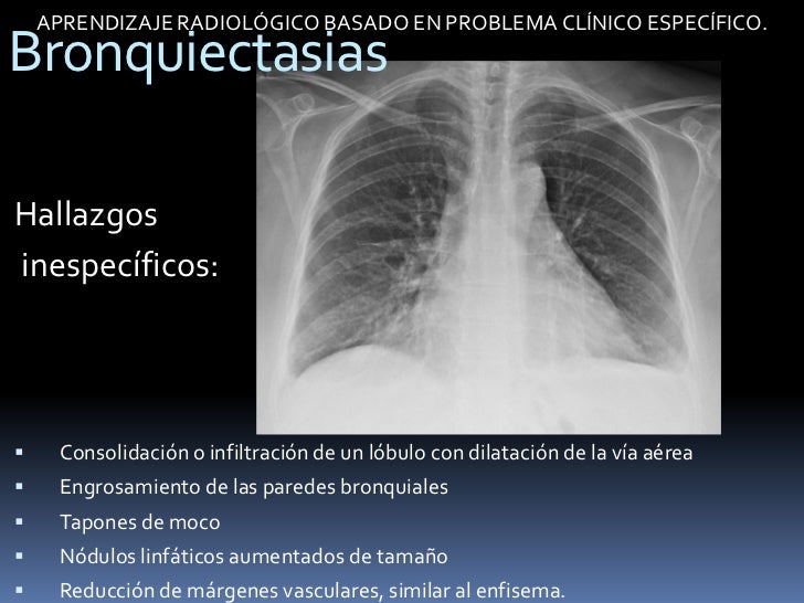 ARBPCE Bronquiectasias
