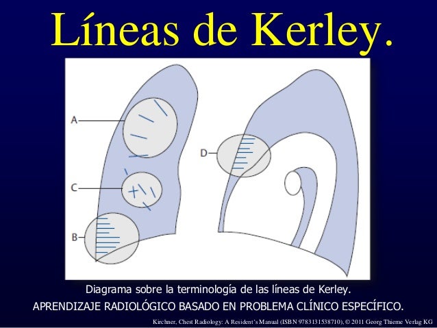 ARBPCE 2014 Lineas de Kerley