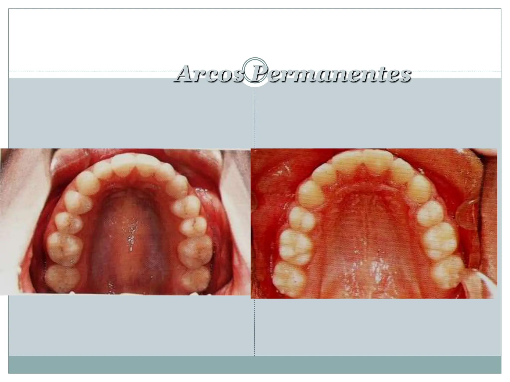 Anatomía Dentaria Arcadas Dentarias Ppt