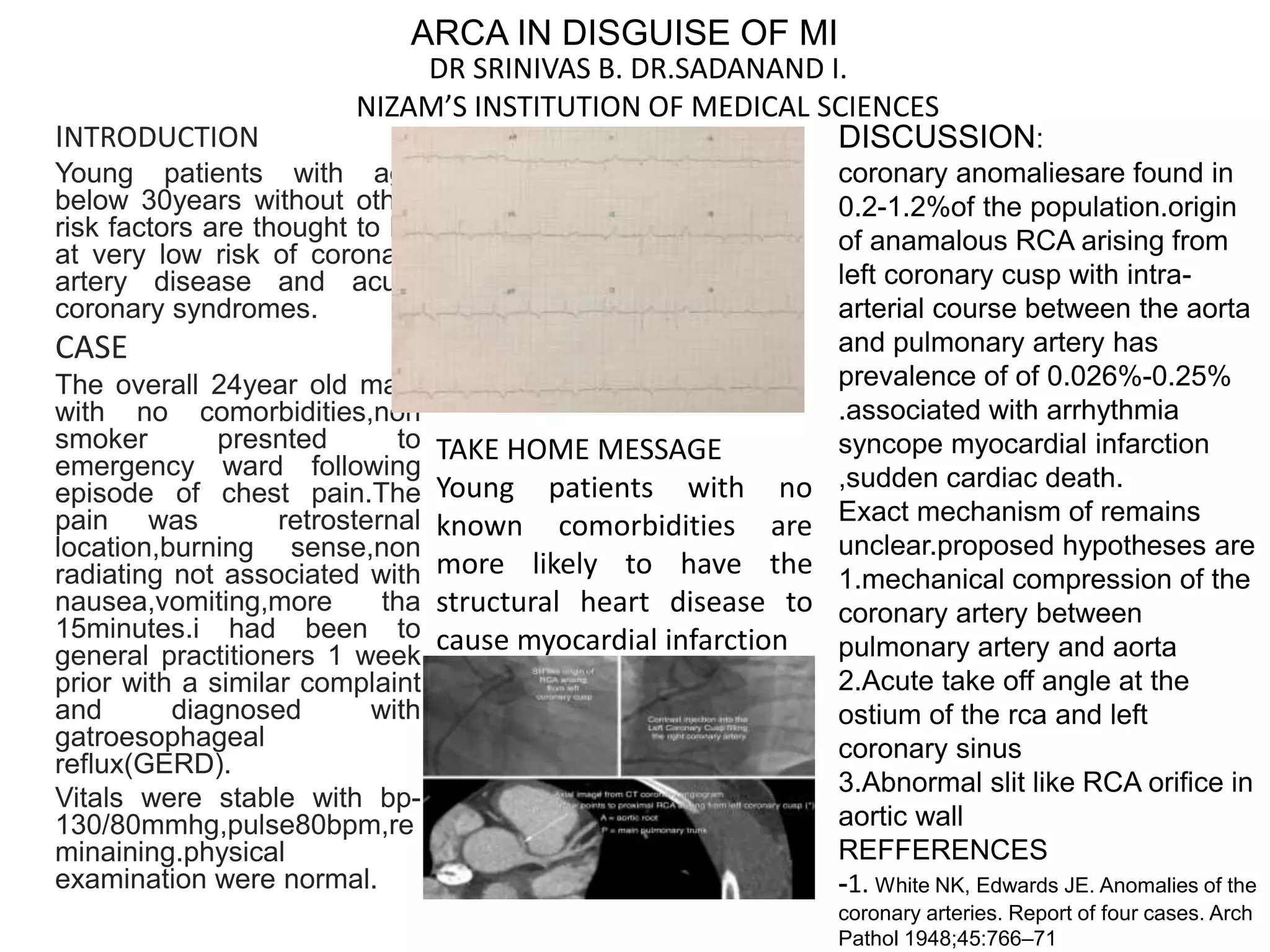 ARCAPA IN DISGUISE OF MI.pptx