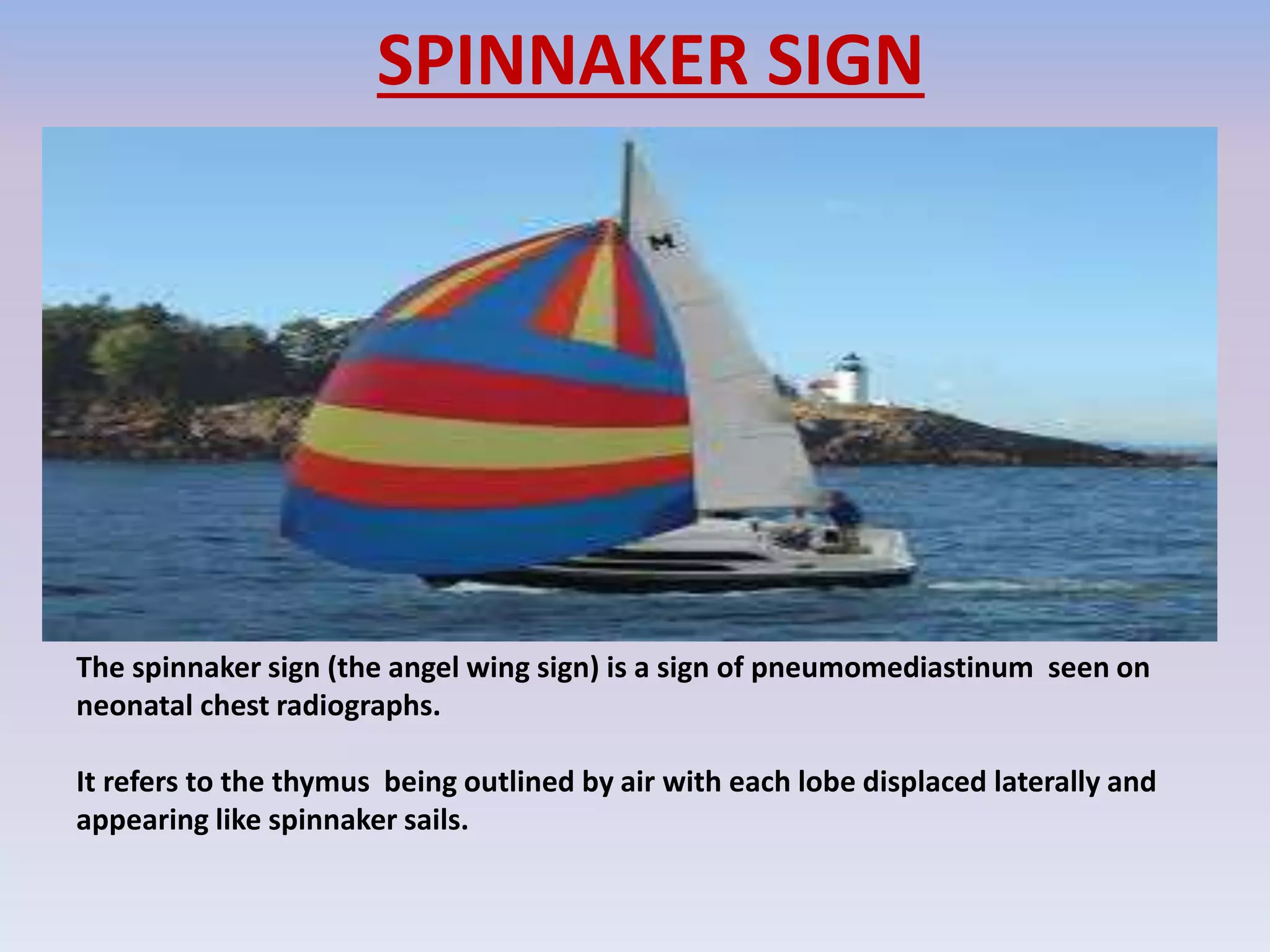 Signs in Chest Xray | PPTX