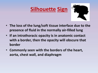 Signs in Chest Xray | PPTX