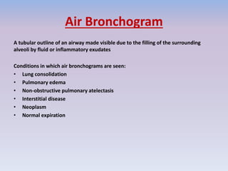 Signs in Chest Xray | PPTX