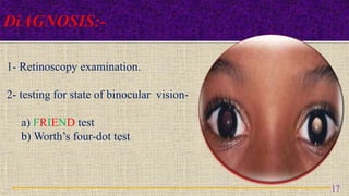 ANISOMETROPIA | PPTX