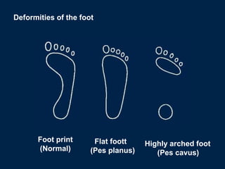 Arches of foot | PPT