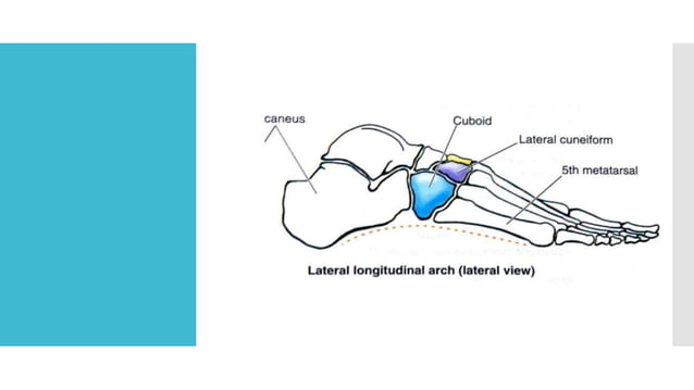 Arches of foot | PPTX