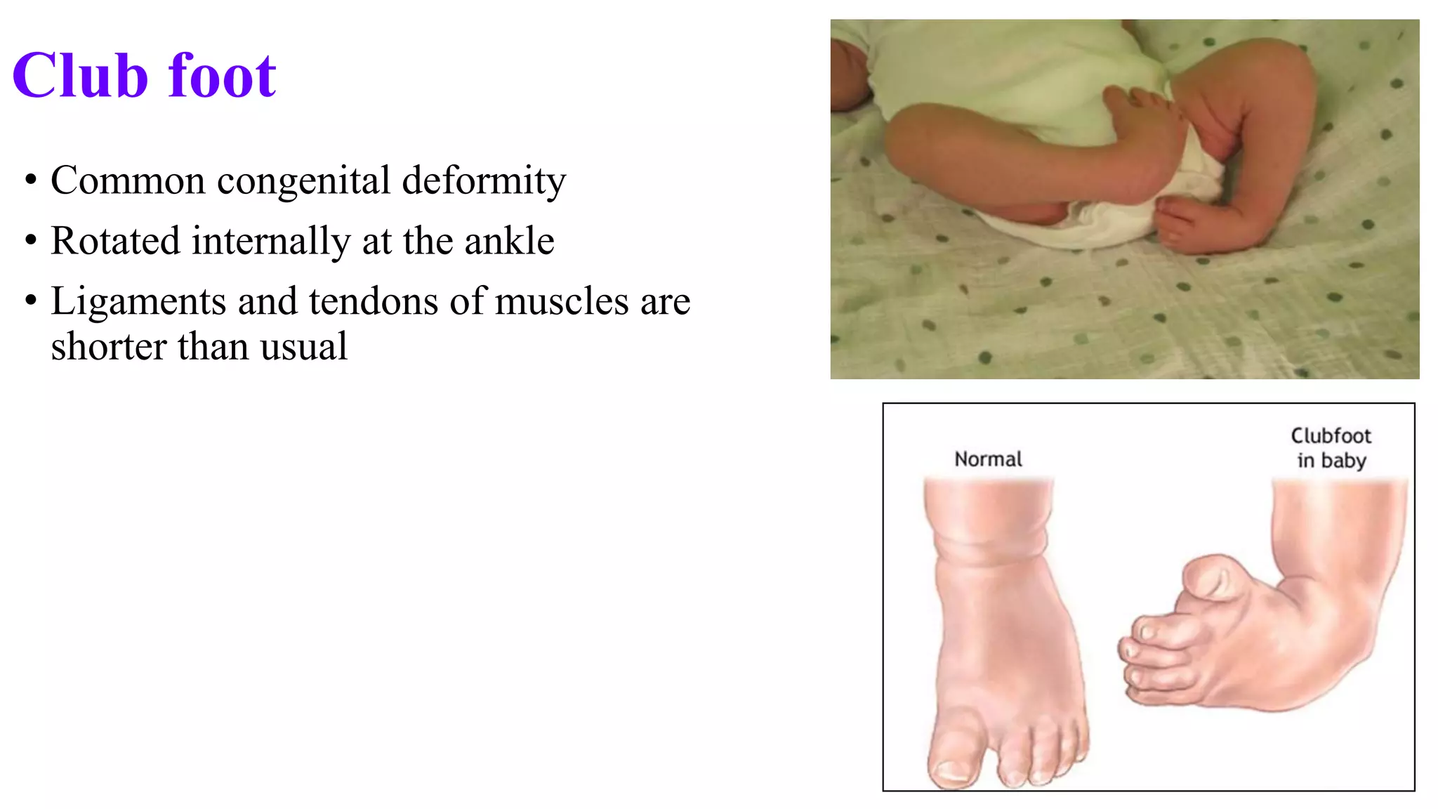 arches of foot.pptx