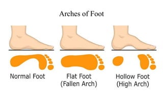 arches of foot.pptx