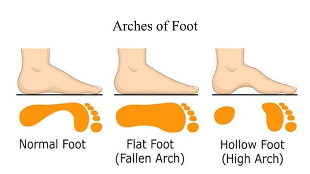 arches of foot.pptx