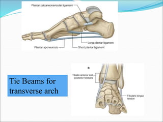 Arches of foot.ppt