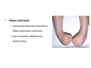ARCHES OF FOOT and sole anatomy with clinical aspect.pptx