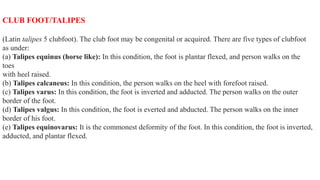 arches of foot: arches of foot and ligaments supporting it.pdf
