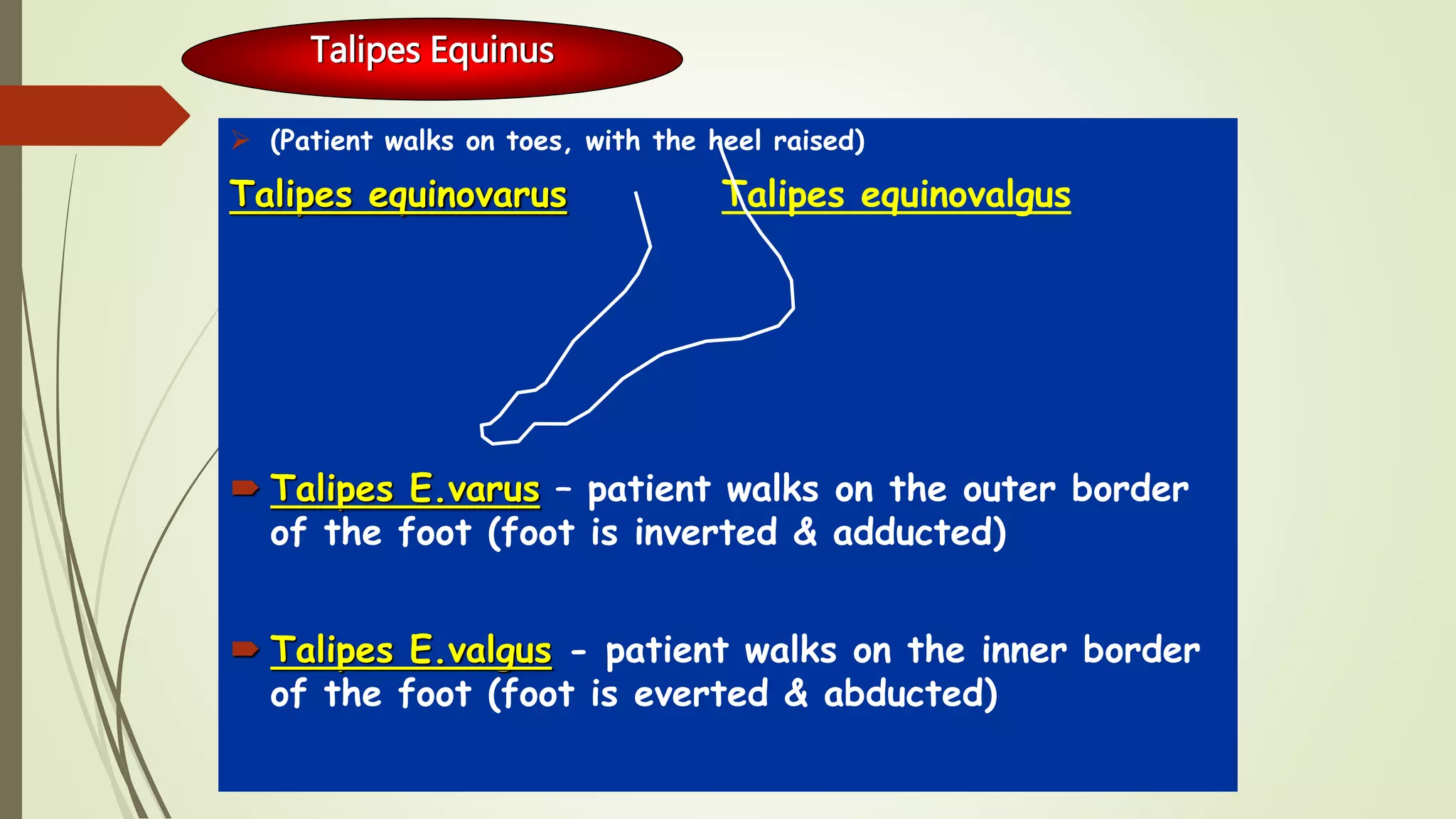Arches of foot | PPTX
