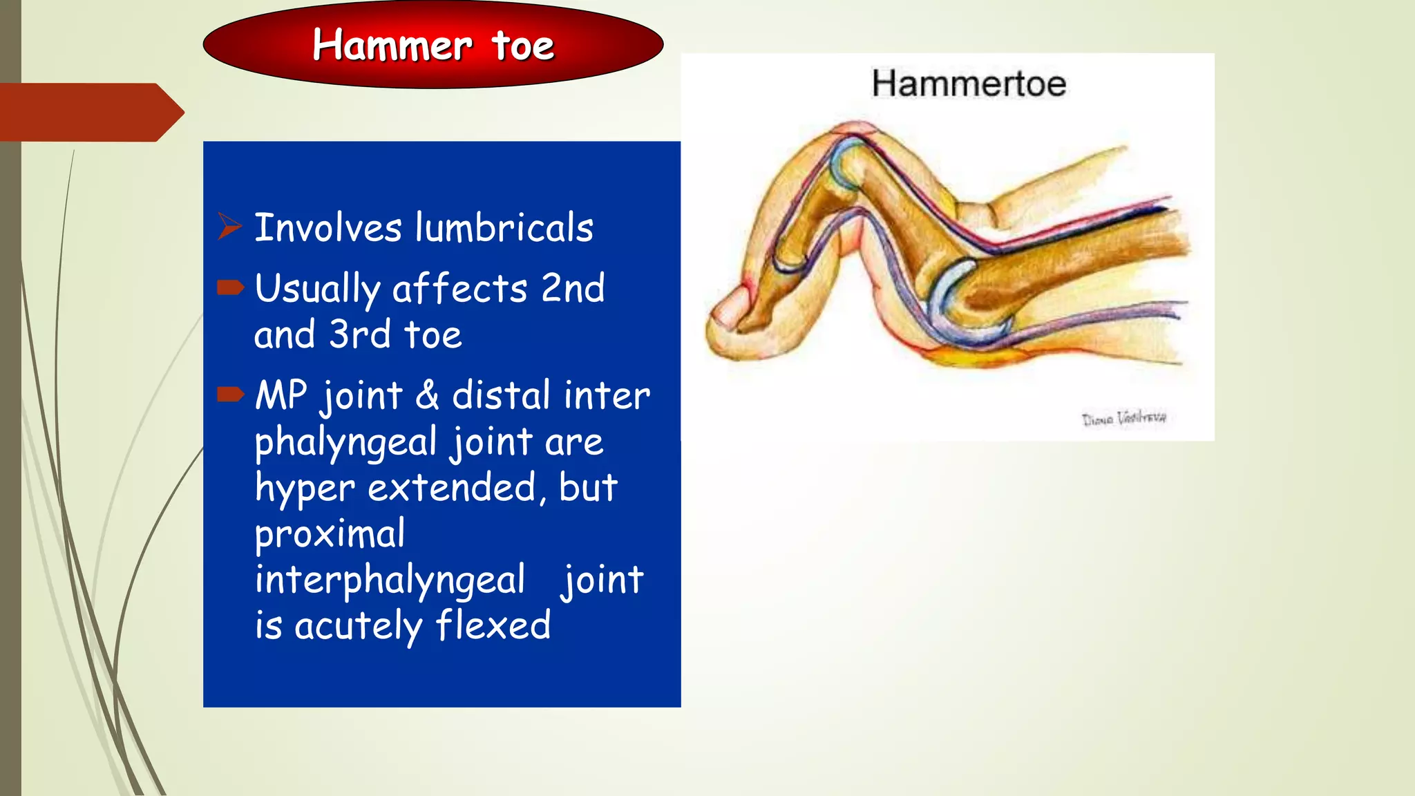 Arches of foot | PPTX