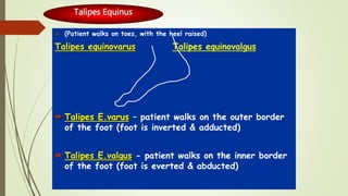 Arches of foot | PPTX
