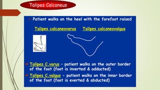 Arches of foot | PPTX