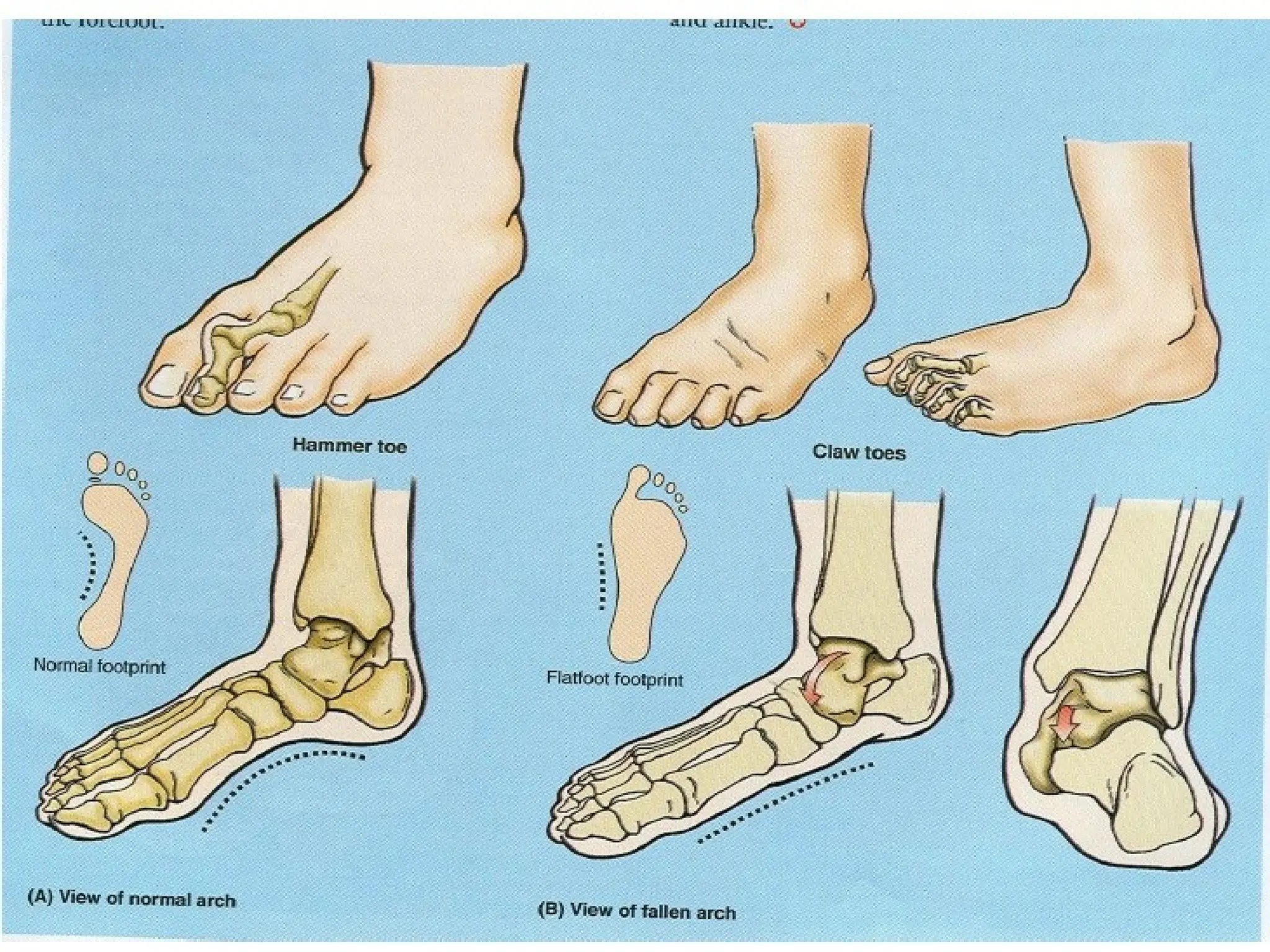 ARCHES OF FOOT 2024 ANTOMY HUMAN ANATOMY | PPT