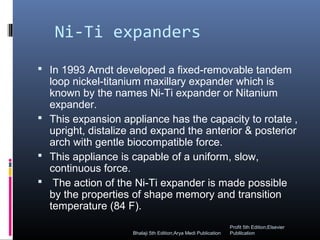Arch expansion | PPT