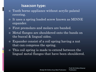 Arch expansion | PPT