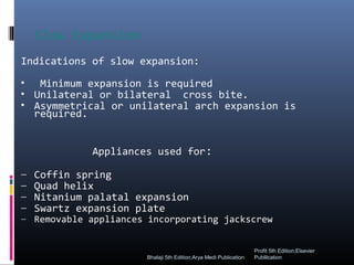 Arch expansion | PPT