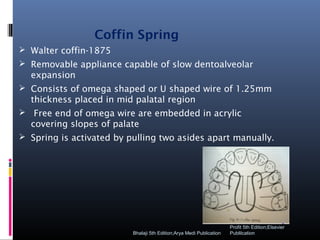 Arch expansion | PPT