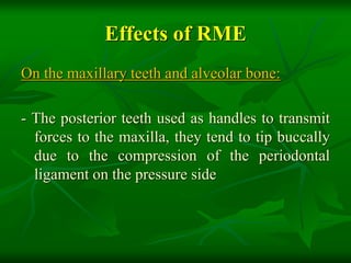 ORTHODONTIC ARCH EXPANSION | PPT