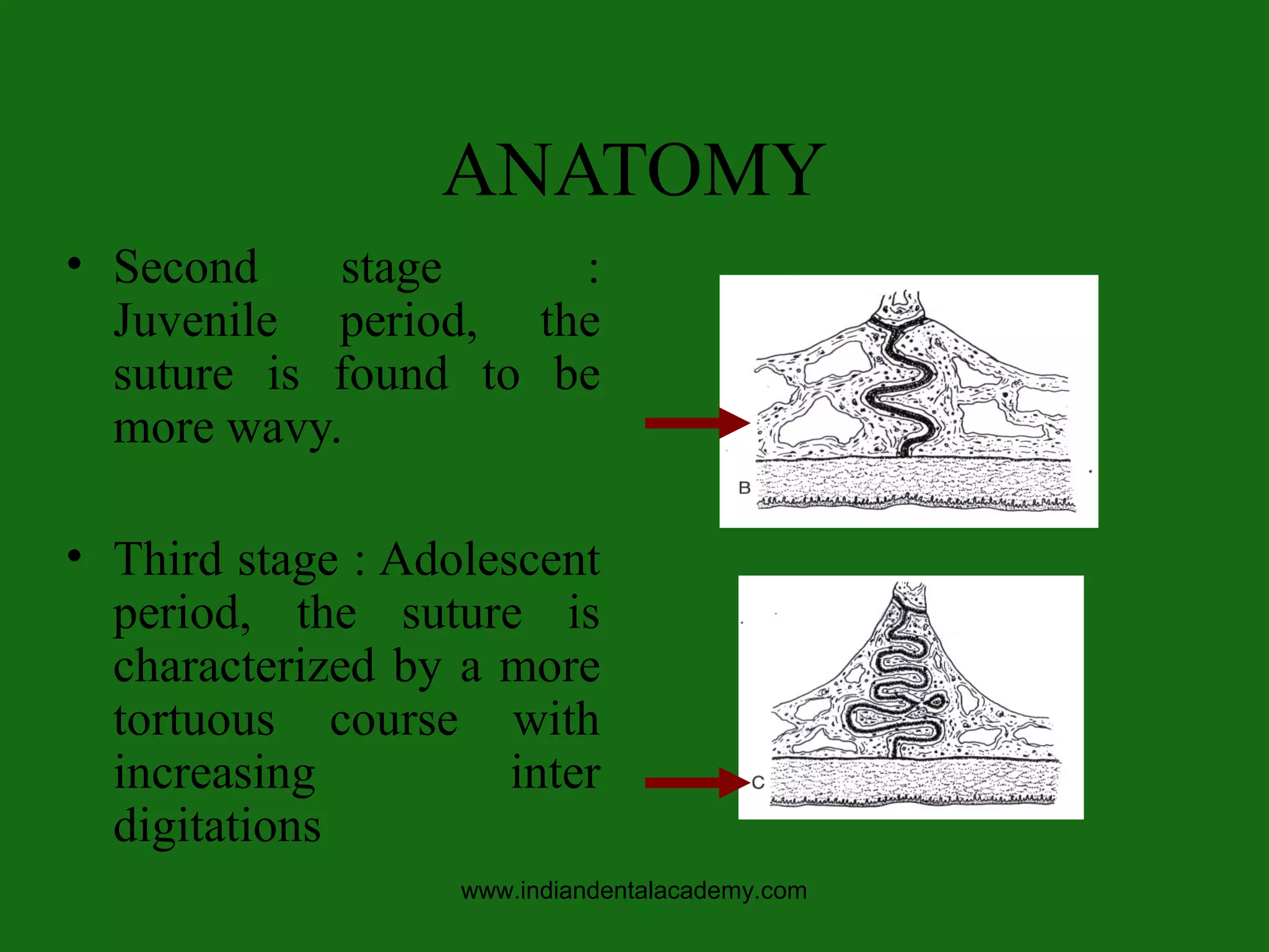 Arch expansion in orthodontics | PPT