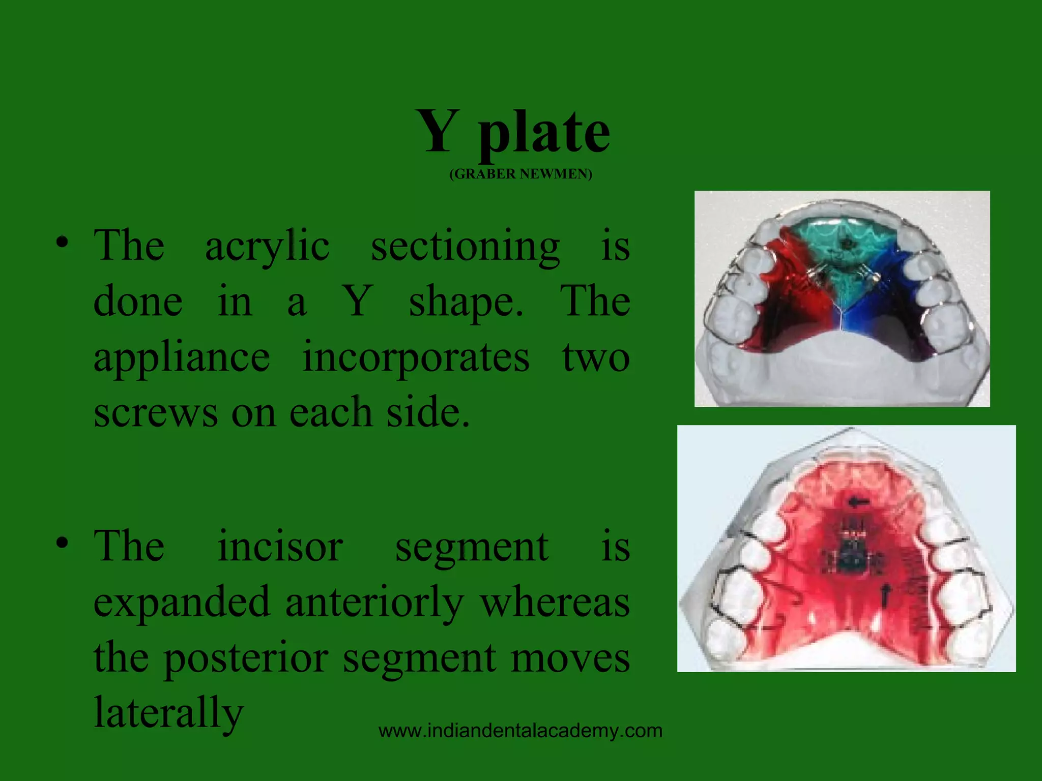 Arch expansion in orthodontics | PPT