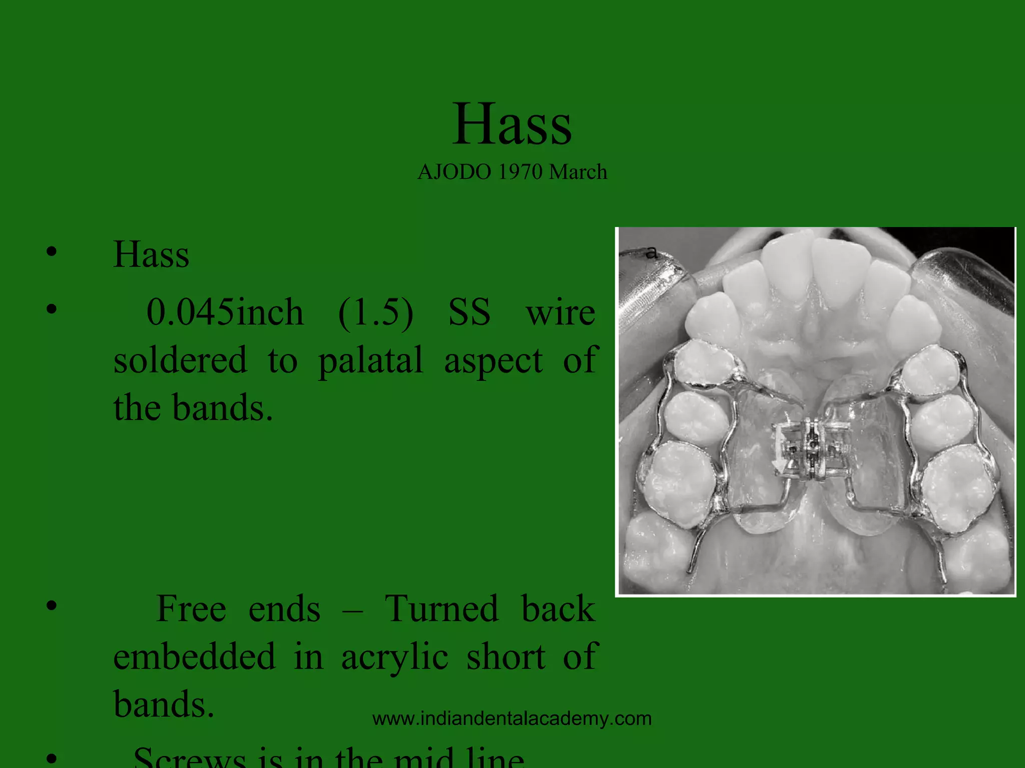 Arch expansion in orthodontics | PPT