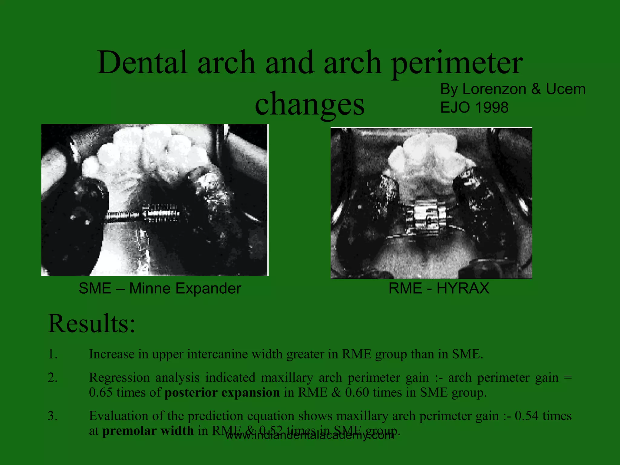 Arch expansion in orthodontics | PPT