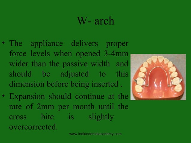 Arch expansion in orthodontics | PPT | Dental Health | Diseases and ...