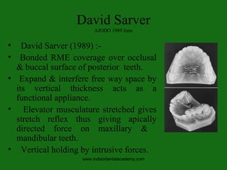 Arch expansion in orthodontics | PPT