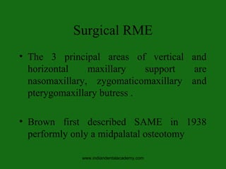Arch expansion in orthodontics | PPT