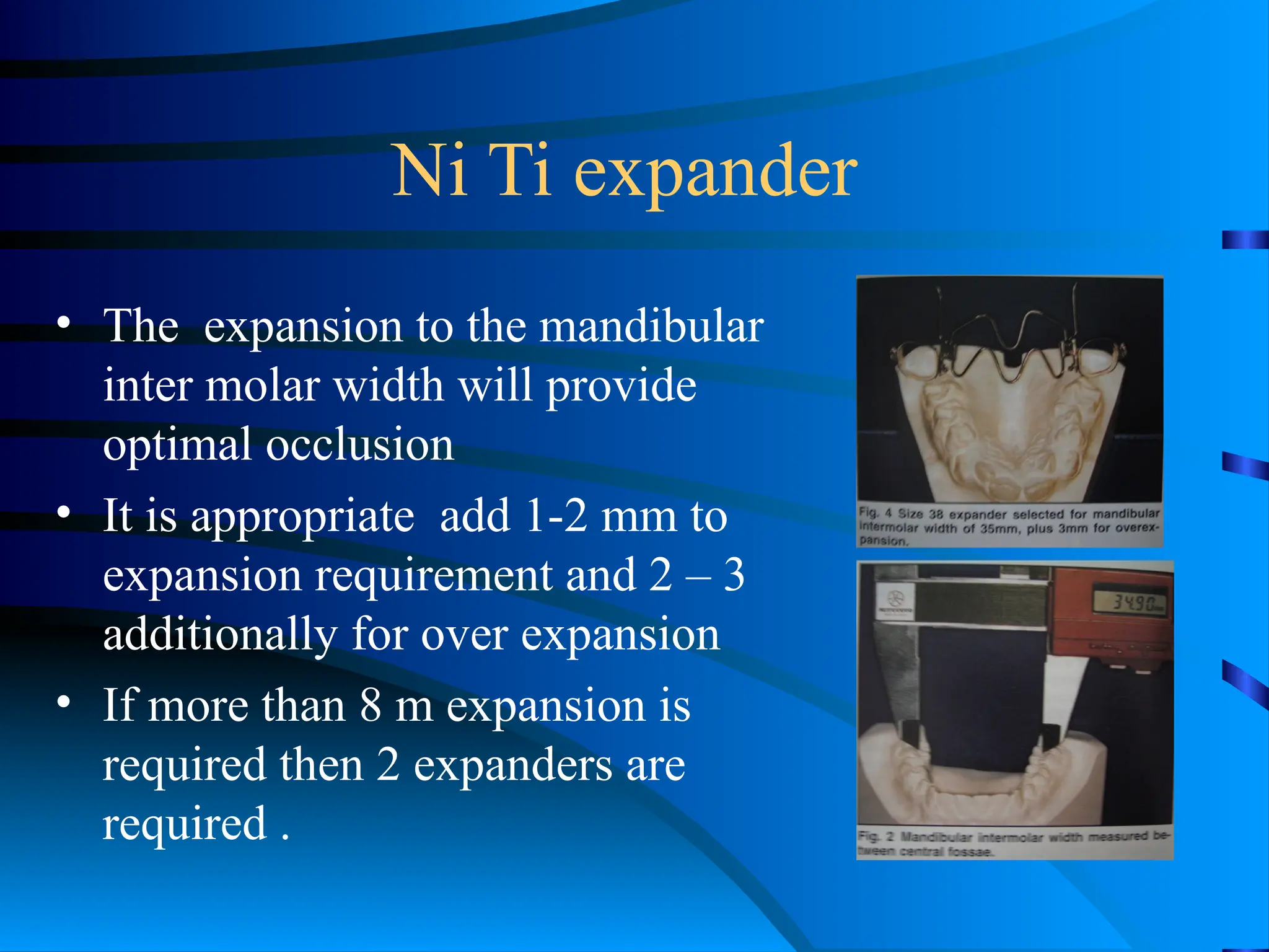 ARCH EXPANSION IN ORTHODONTICS ddd (2).ppt