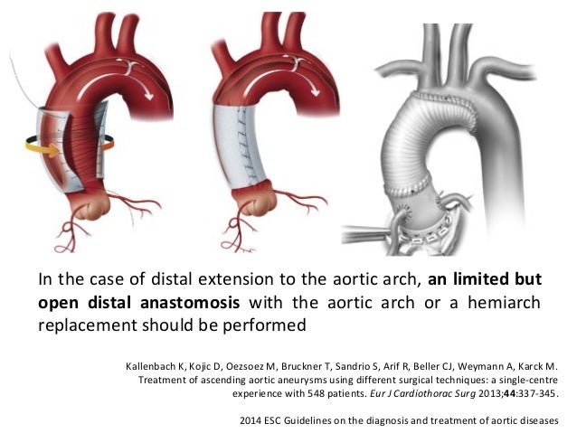 Arch final harkit2015