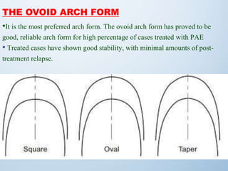 Arch form | PPTX