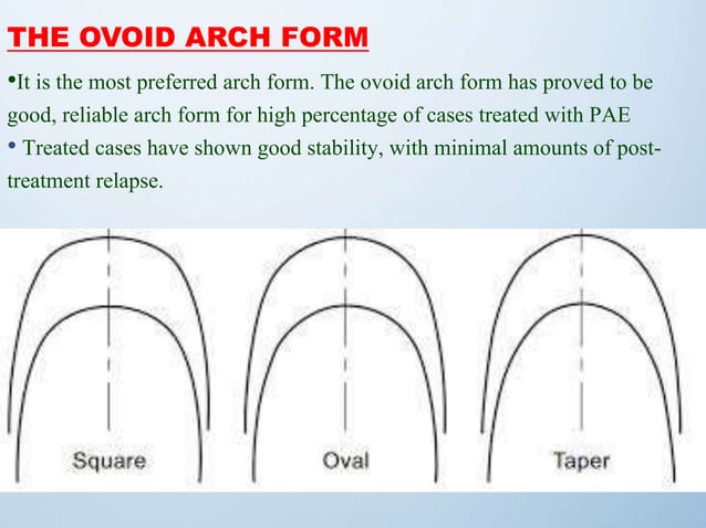 Arch form | PPTX | Dental Health | Diseases and Conditions