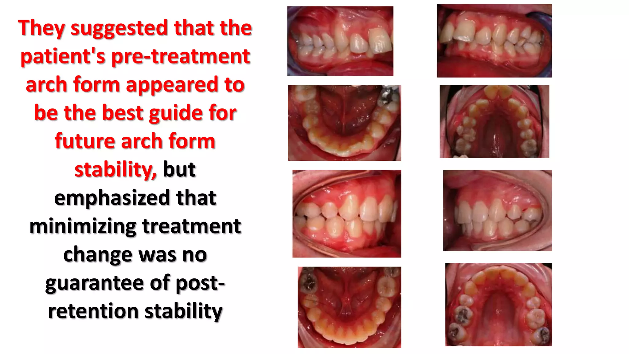 orthodontic arch form | PPTX