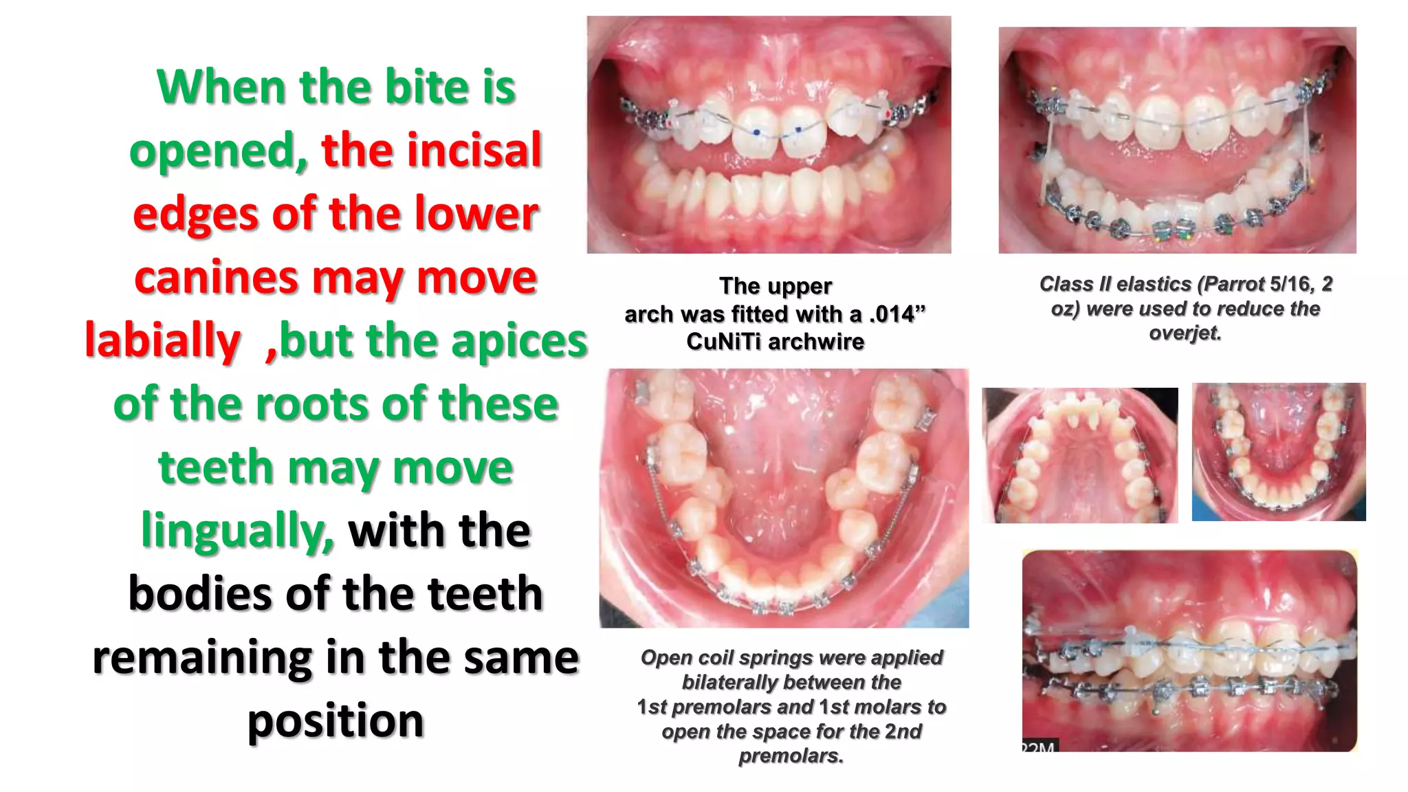 orthodontic arch form | PPTX
