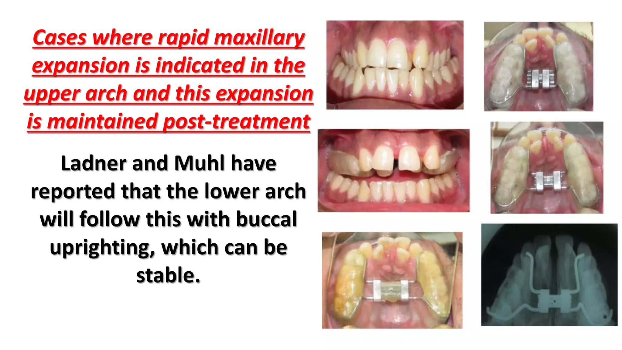 orthodontic arch form | PPTX