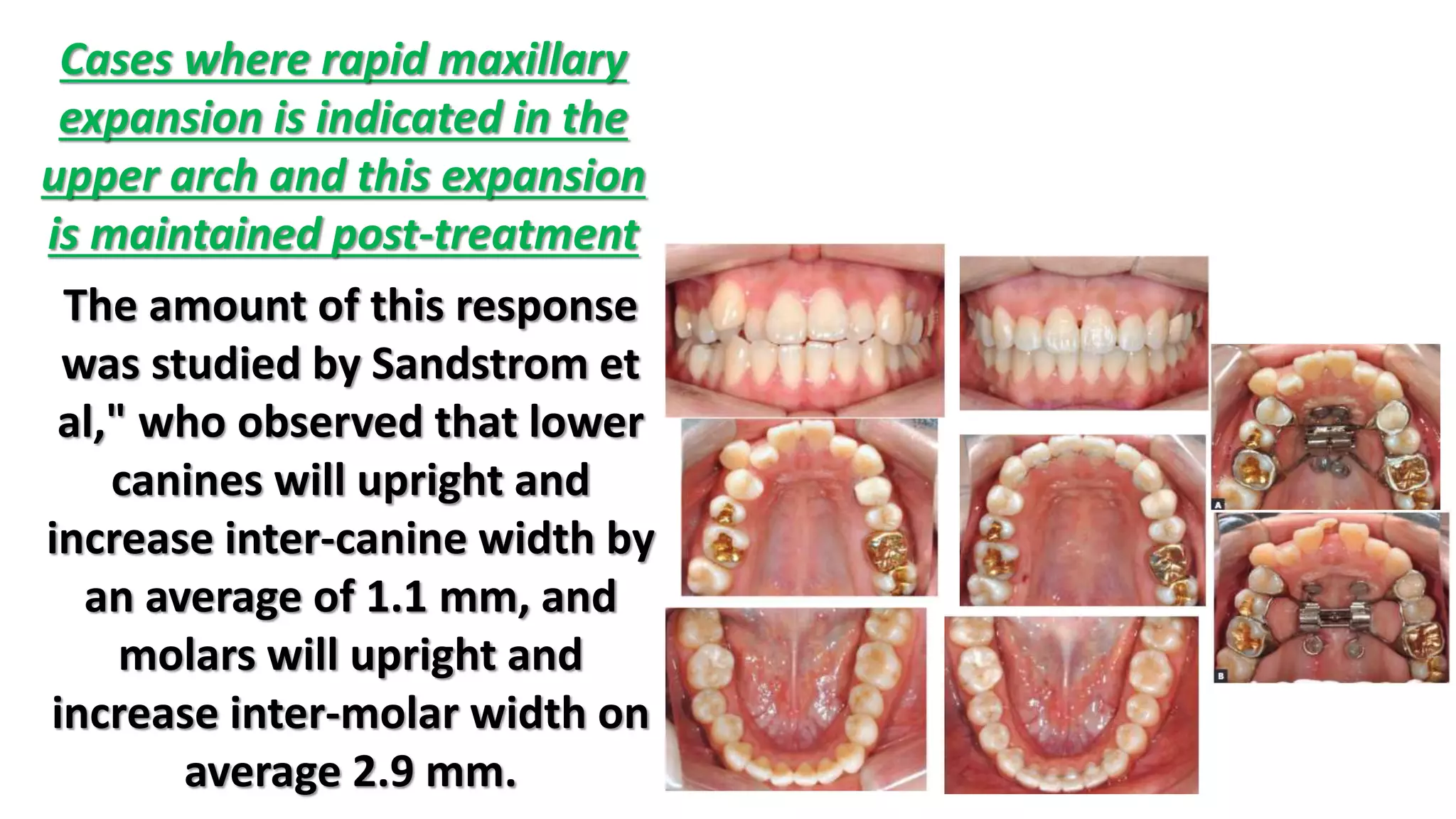 orthodontic arch form | PPTX