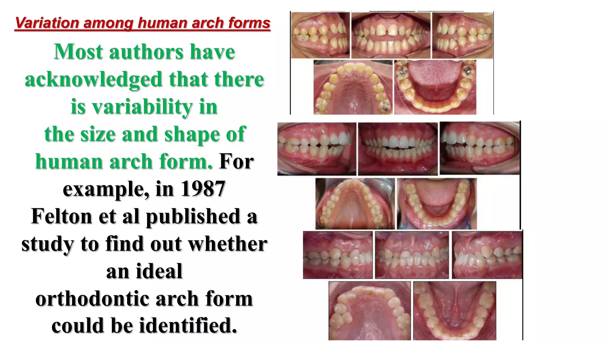 orthodontic arch form | PPTX