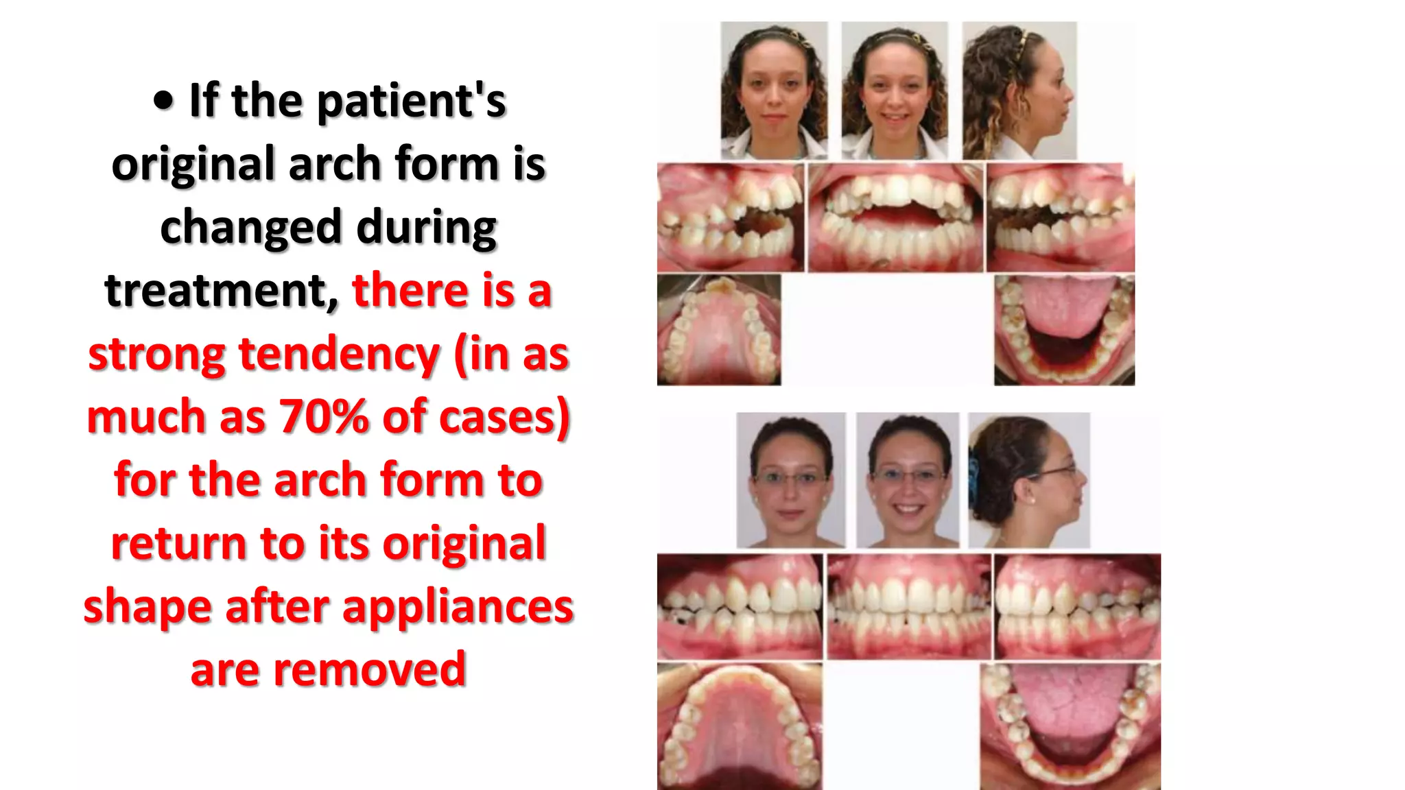 orthodontic arch form | PPTX