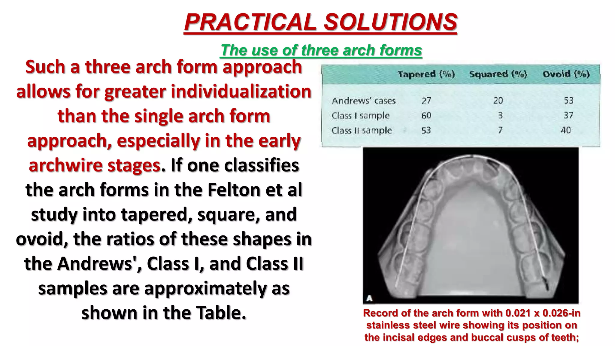 orthodontic arch form | PPTX