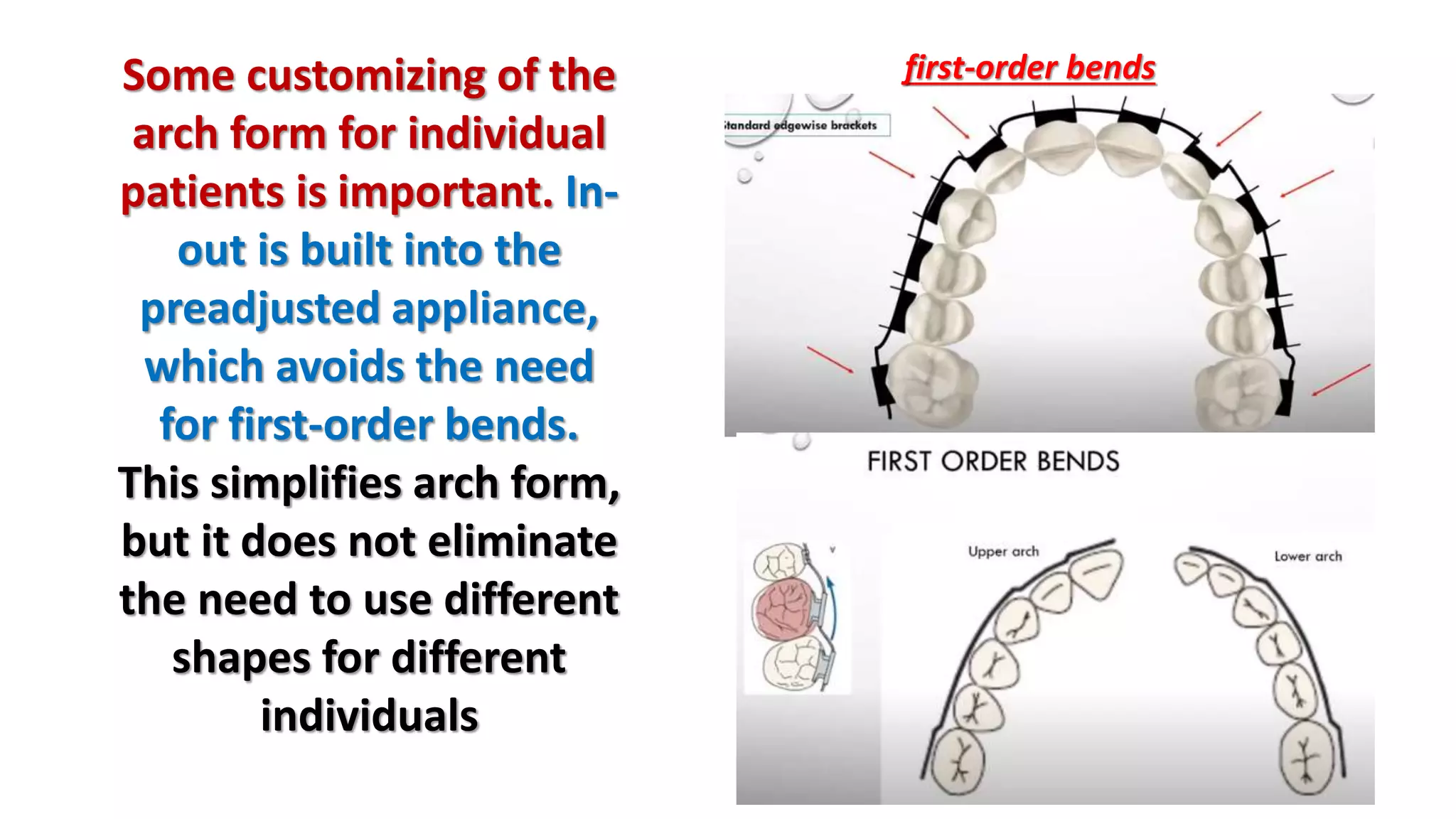 orthodontic arch form | PPTX
