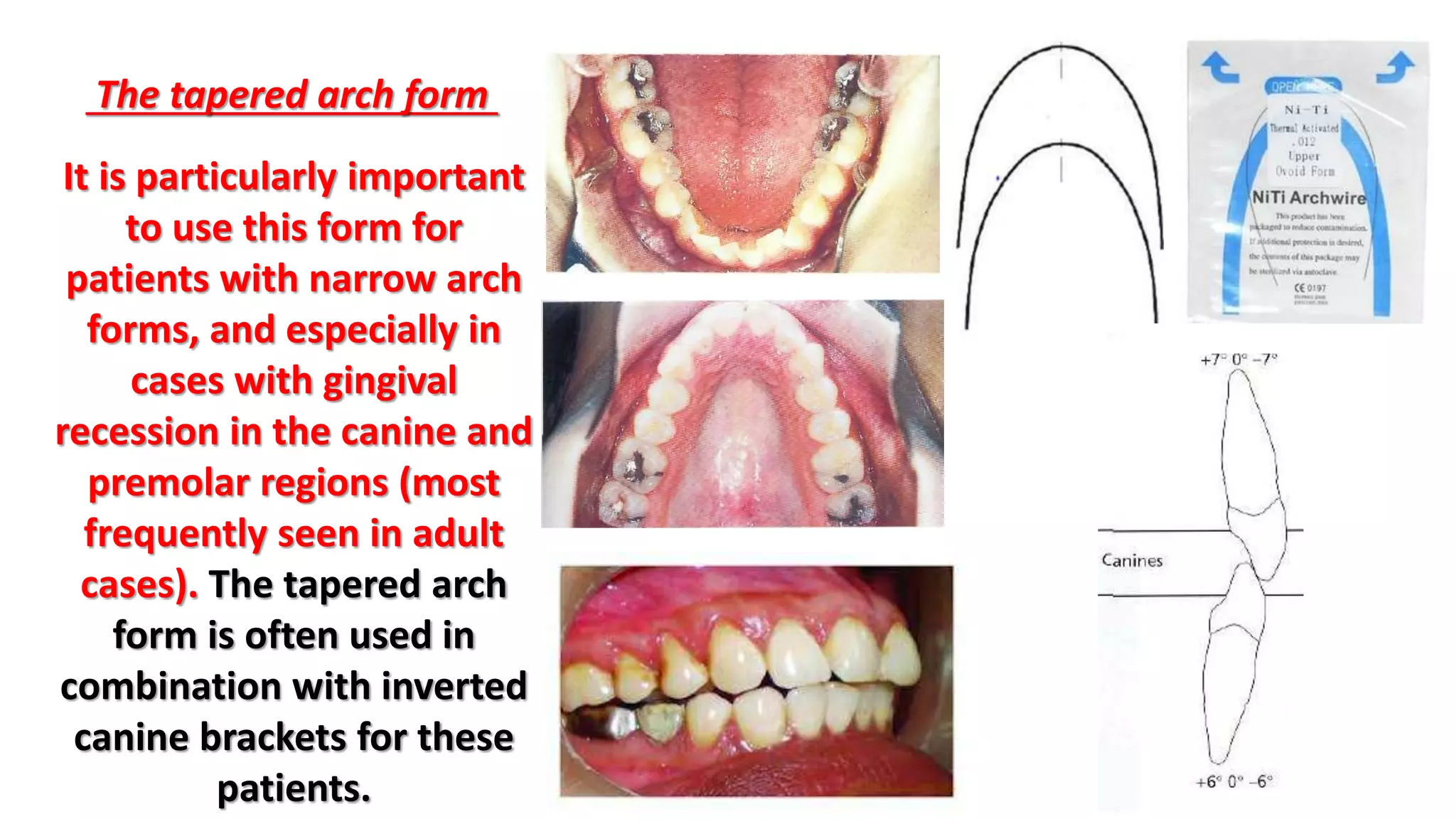 orthodontic arch form | PPTX