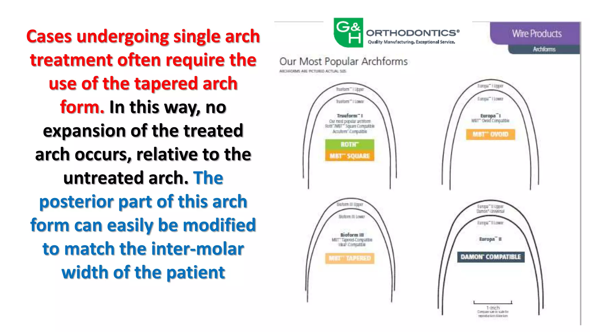orthodontic arch form | PPTX