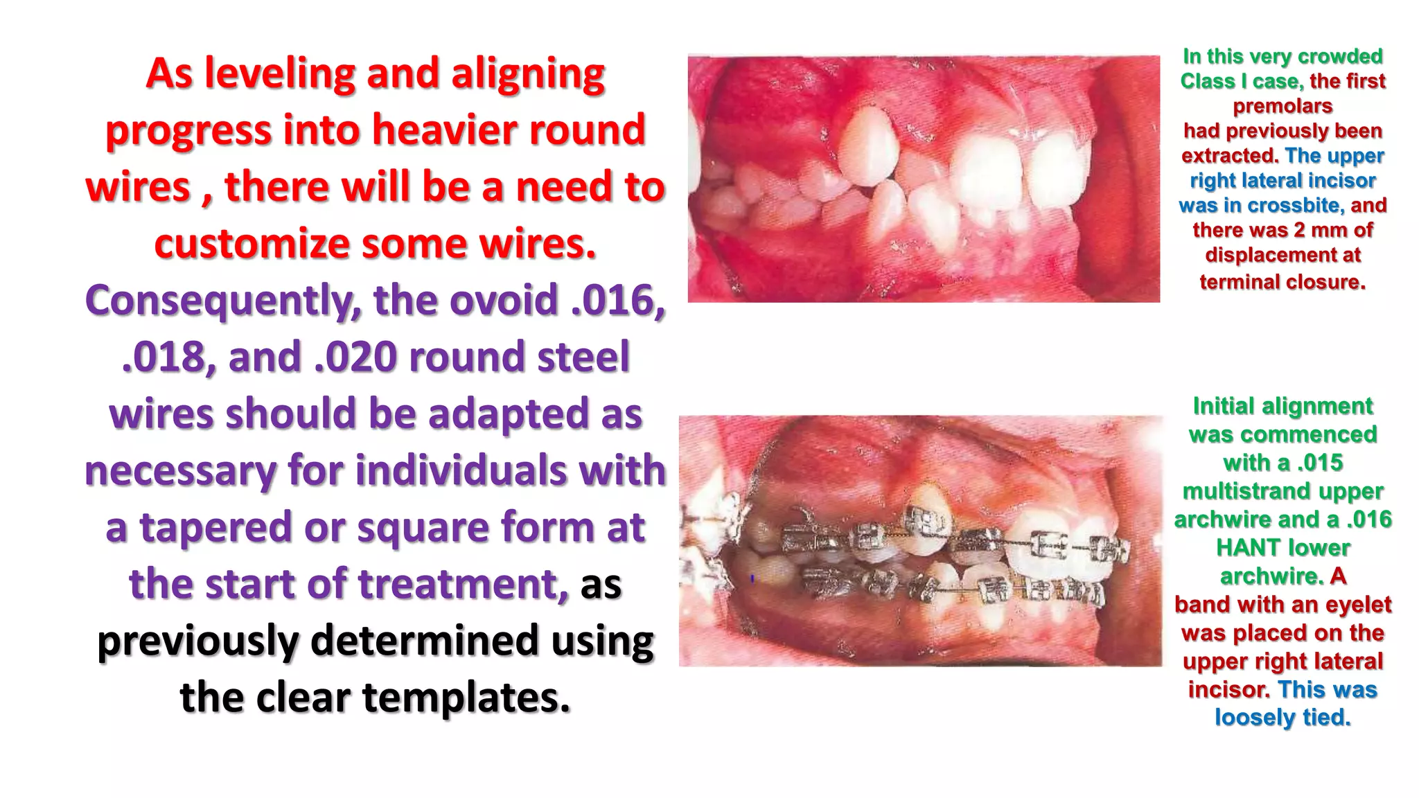 orthodontic arch form | PPTX