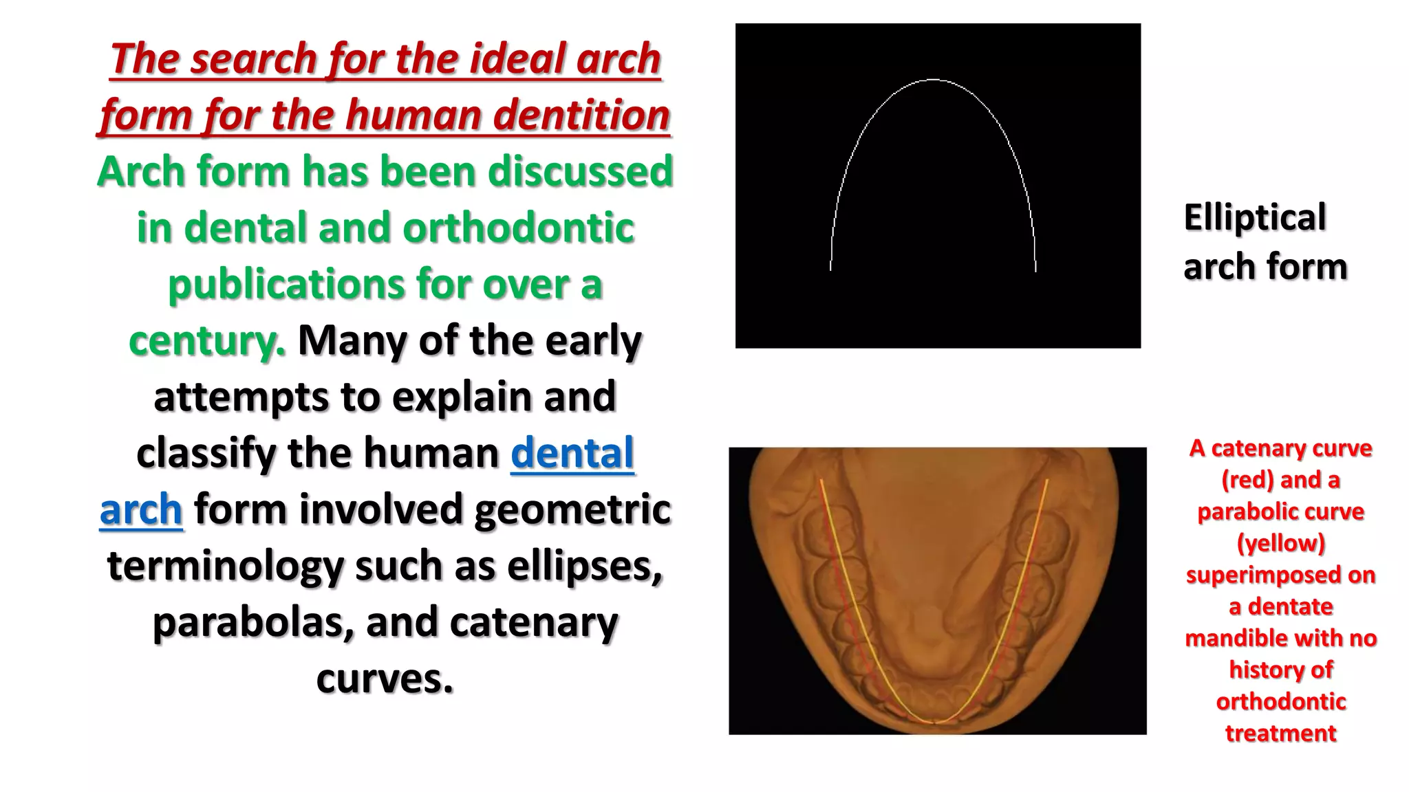 orthodontic arch form | PPTX