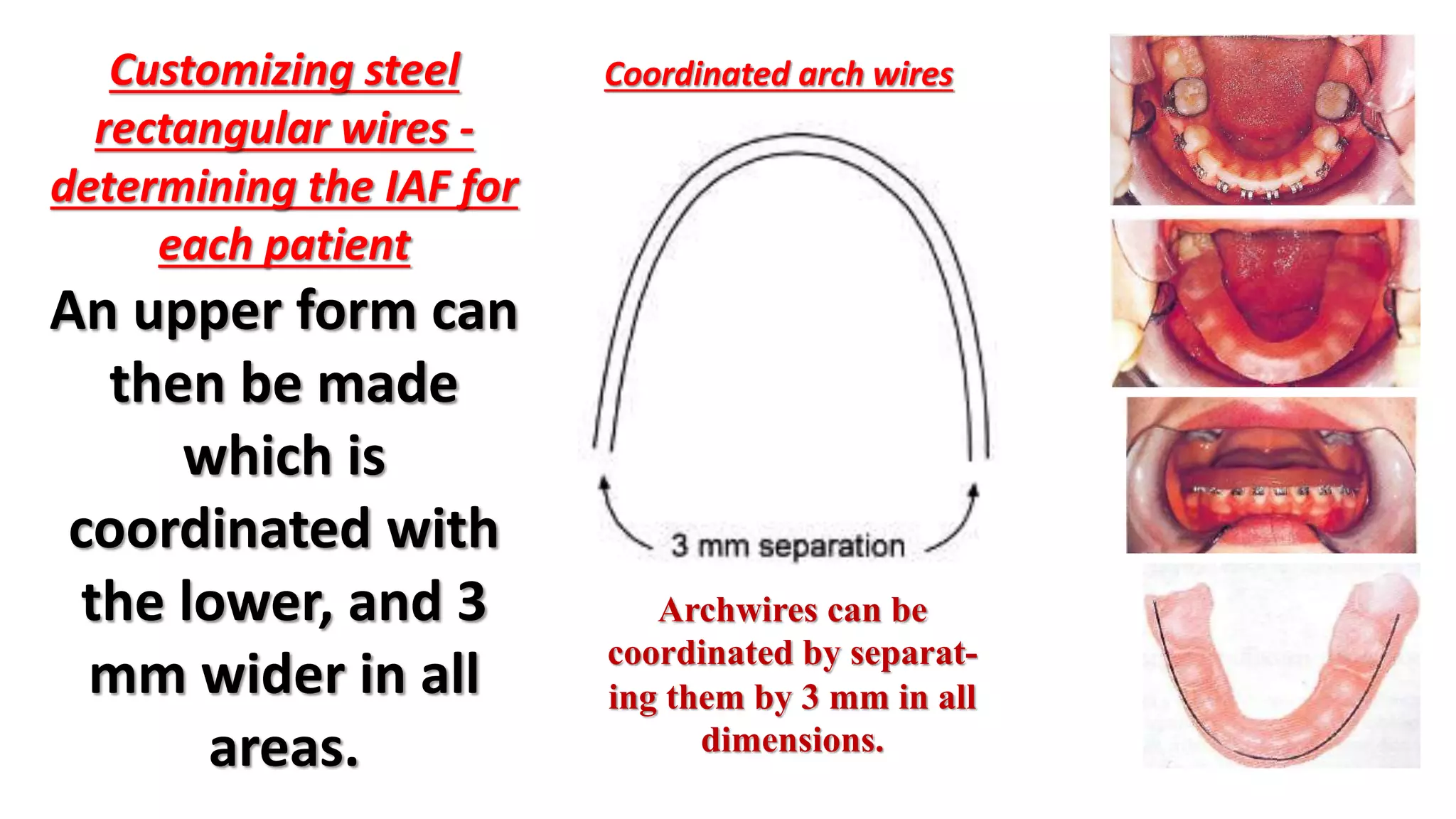 orthodontic arch form | PPTX